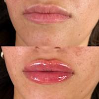 Eye Envy Aesthetics, Great Yarmouth | Beauty Salons - Yell