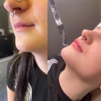 Volume Aesthetics, Ilkeston | Clinics - Yell