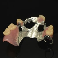 Butterfly Dental Laboratory, Oswestry | Dental Technicians - Yell